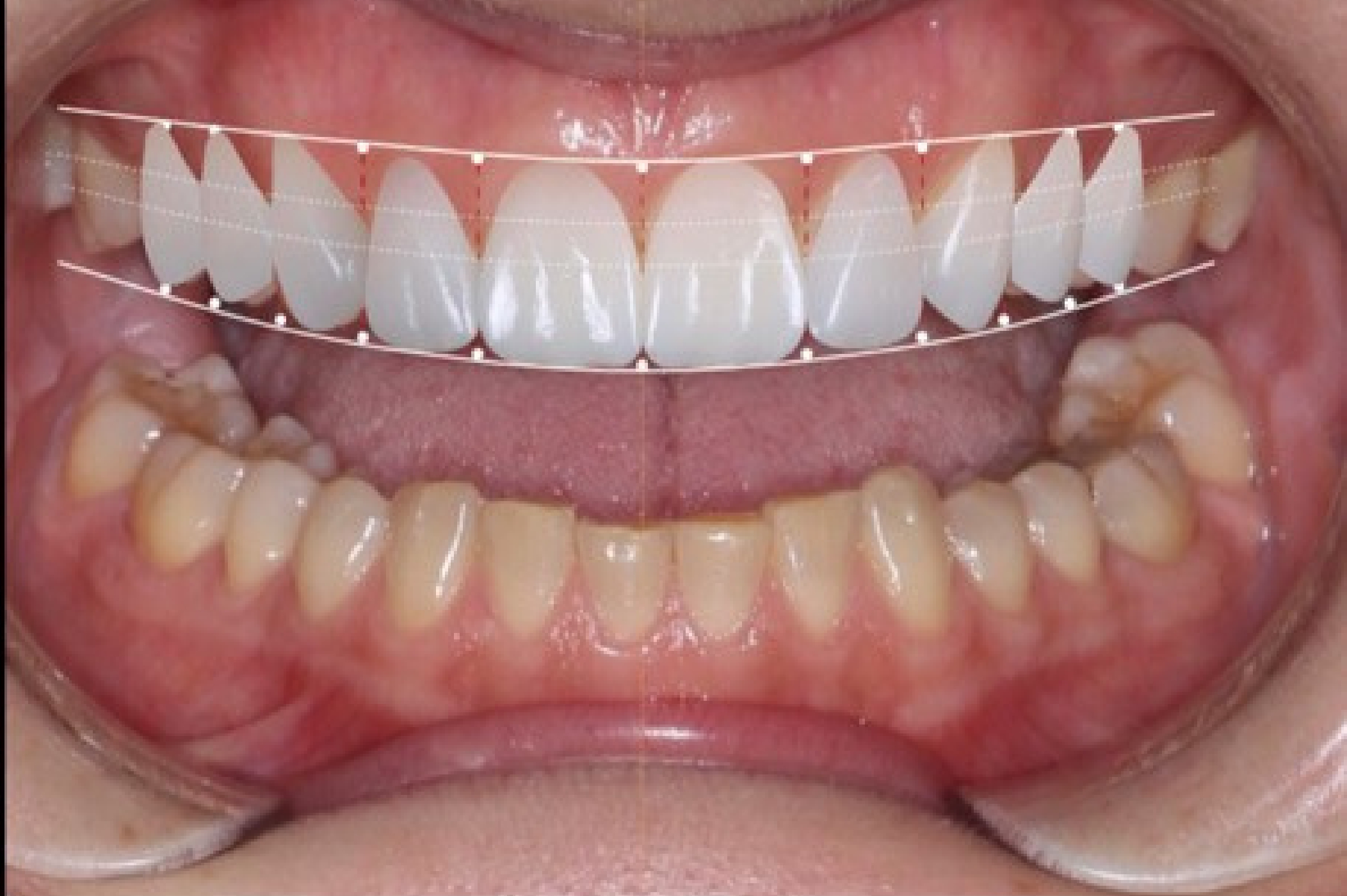 Expert Digital Smile Designing | SmileWorks